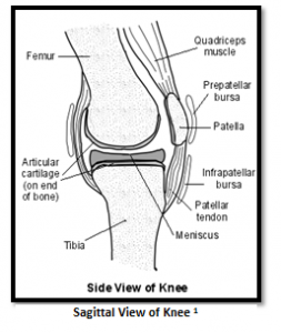 Case Study in Prepatellar Bursitis